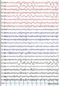 Seenel Imaging - functional neuroimaging device: combined EEG/fNIRS | Seenel Imaging