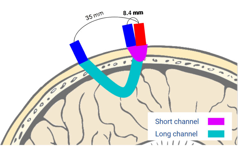 Seenel Imaging - functional neuroimaging device: combined EEG/fNIRS | Seenel Imaging